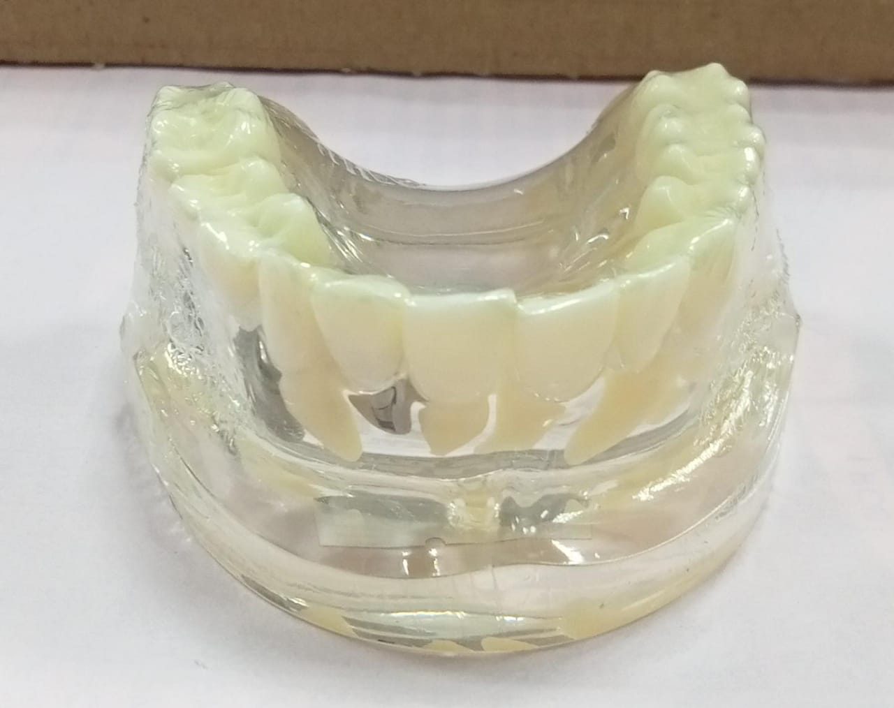 TOOTH MODEL
