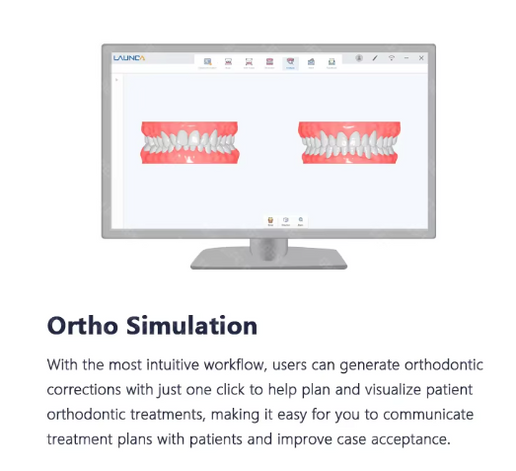 COXO DL 300P INTRAORAL SCANNER